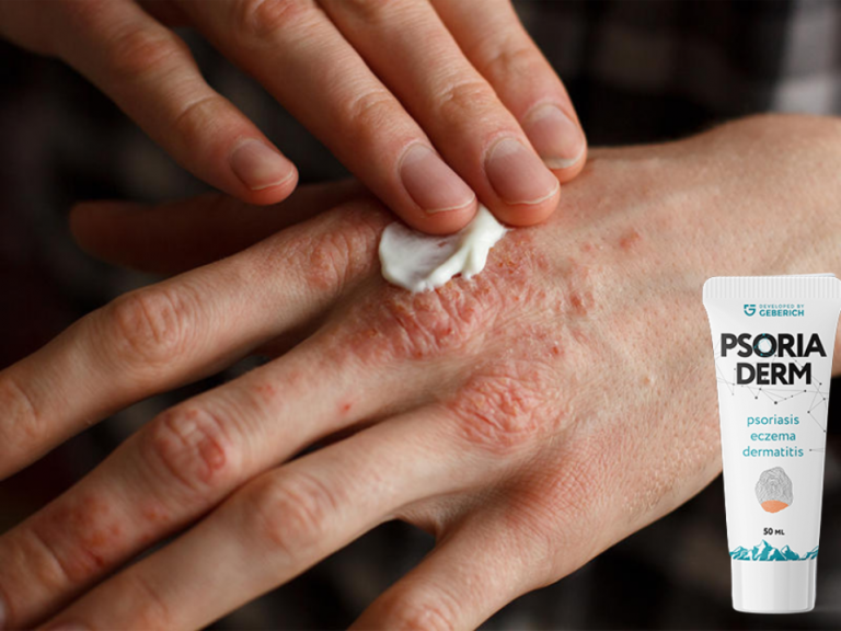 Psoriaderm ES | DC – Beauty Routine